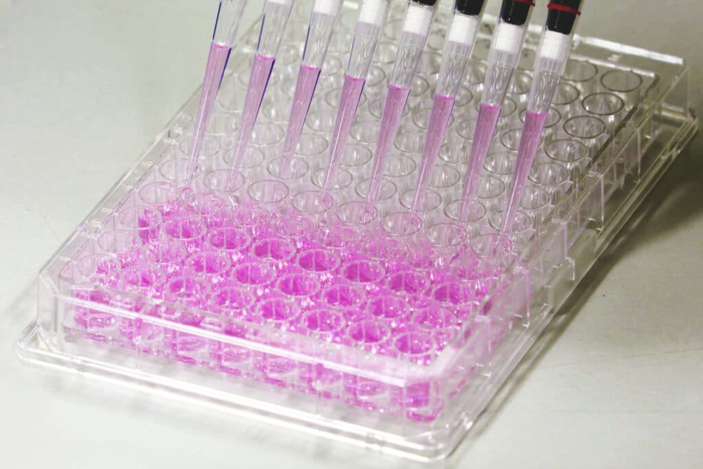 Assay Ready Cells for Cell-Based Assays | MaxCyte